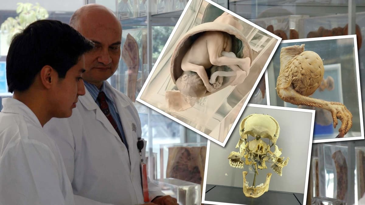 Chilango - Museos inusuales de CDMX: Cadáveres hasta cerdos cíclopes